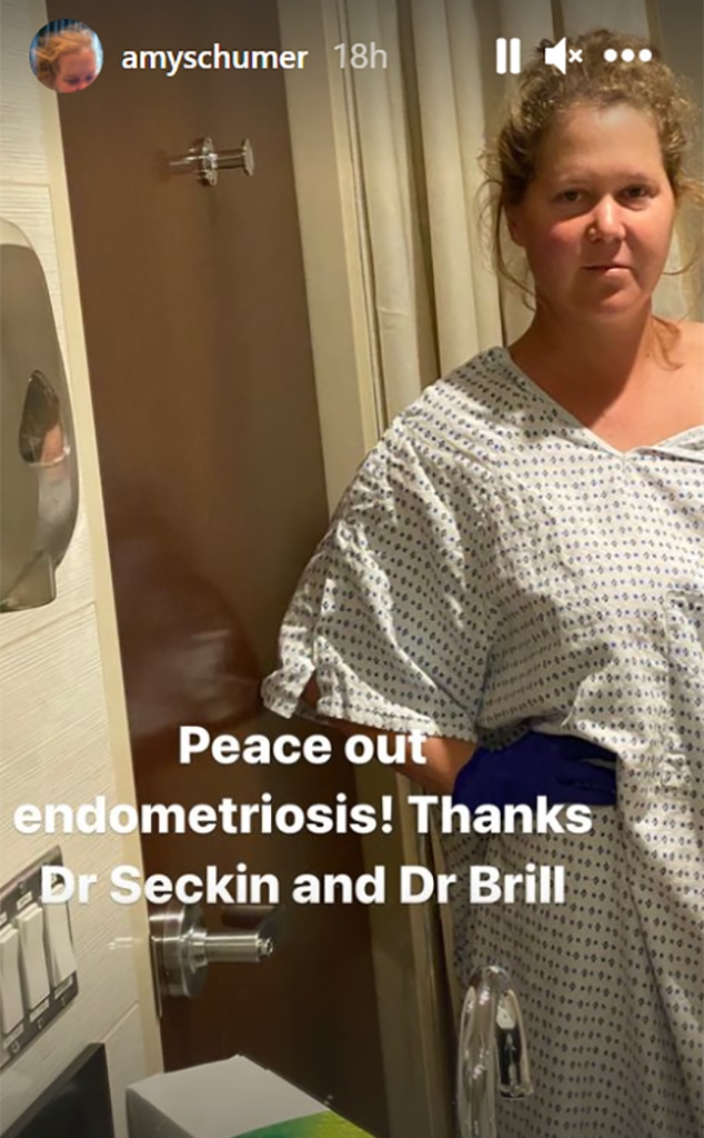 Amy Schumer Gets A Uterus Removal Surgery Shares Her Struggle
